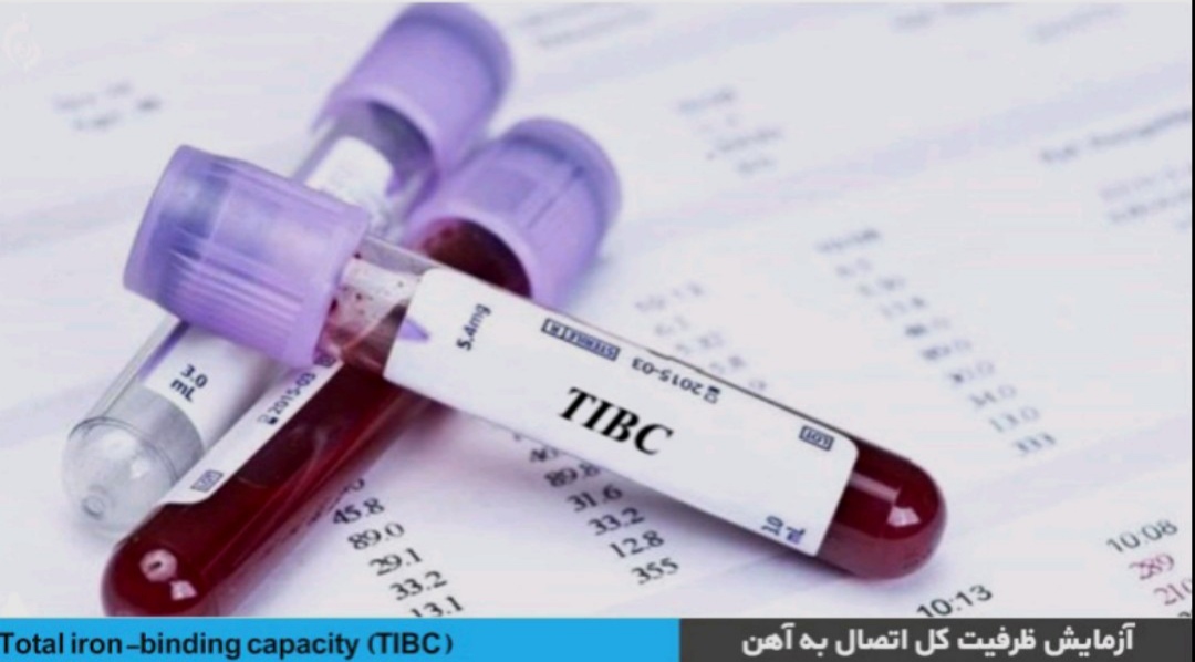 Total iron-binding capacity (TIBC) | اتحاد زیست شناسان ایران